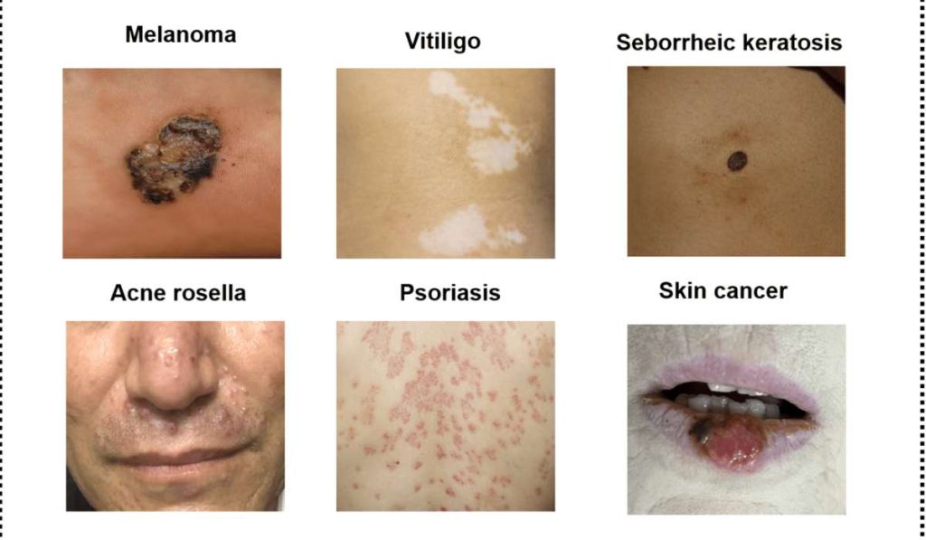 انواع بیماری های پوستی : معرفی 20 بیماری شایع پوستی